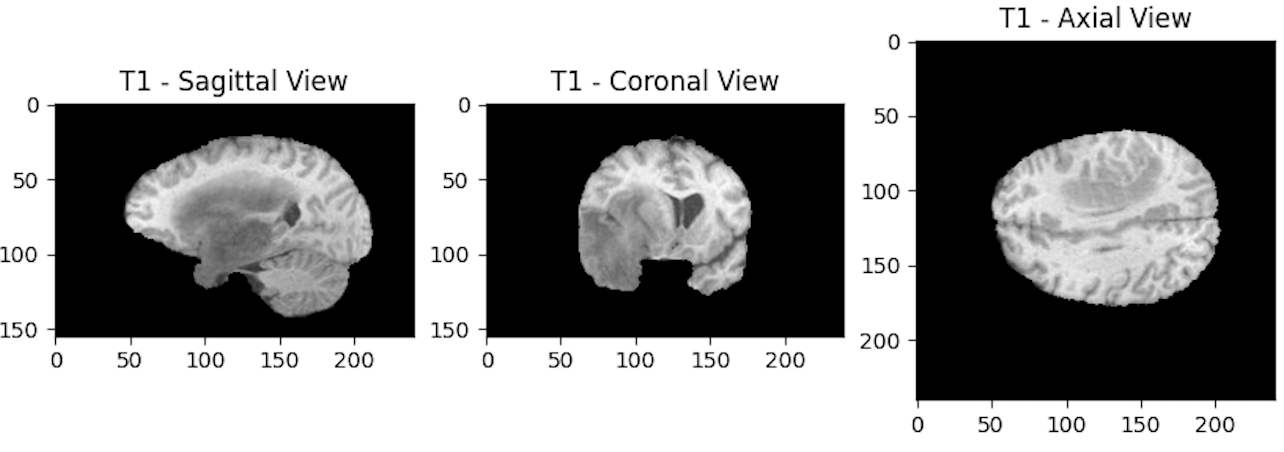 Image segmentation: Train a U-Net model to segment brain tumors ...