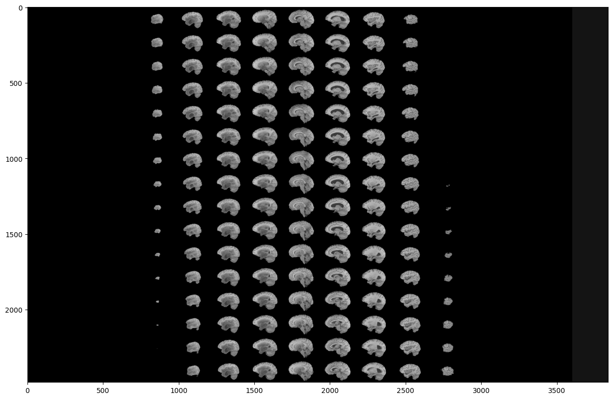 Image segmentation: Train a U-Net model to segment brain tumors ...