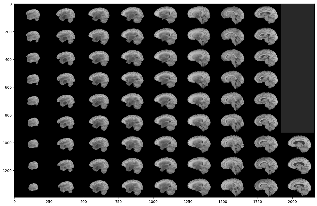 Image segmentation: Train a U-Net model to segment brain tumors ...