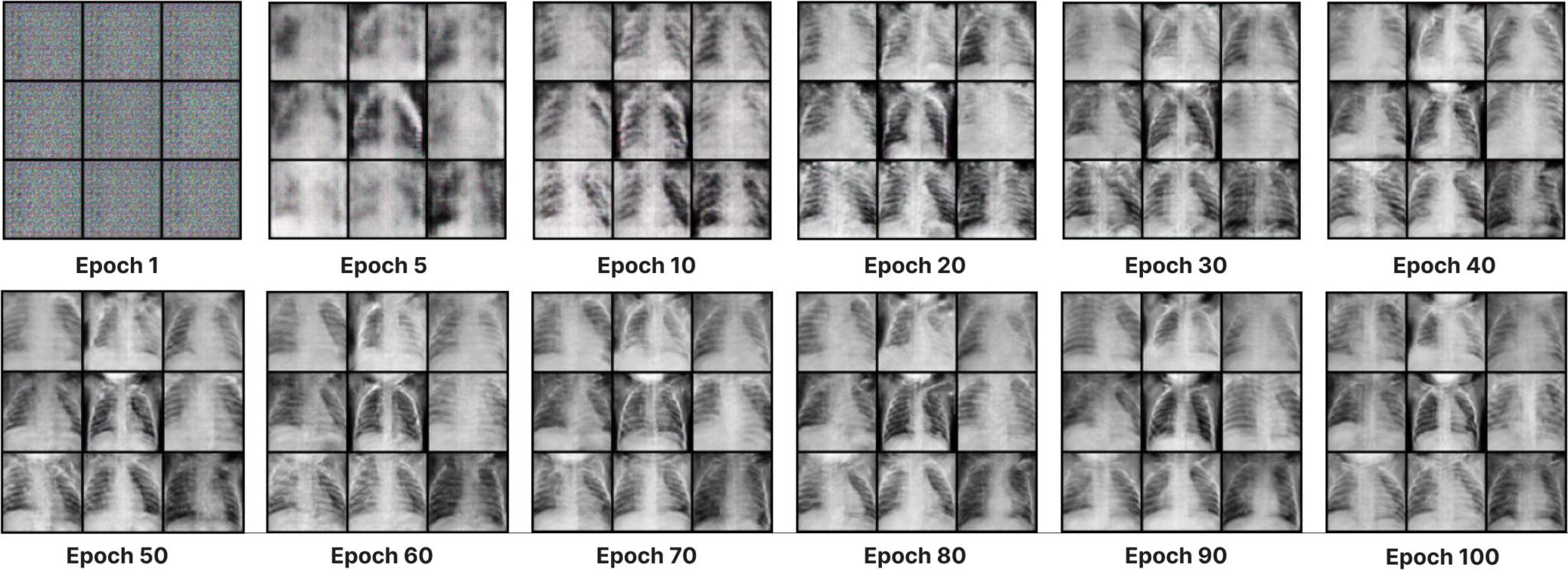 Understanding Image Generation: A Beginner's Guide to Generative Adversarial Networks - OVHcloud ...