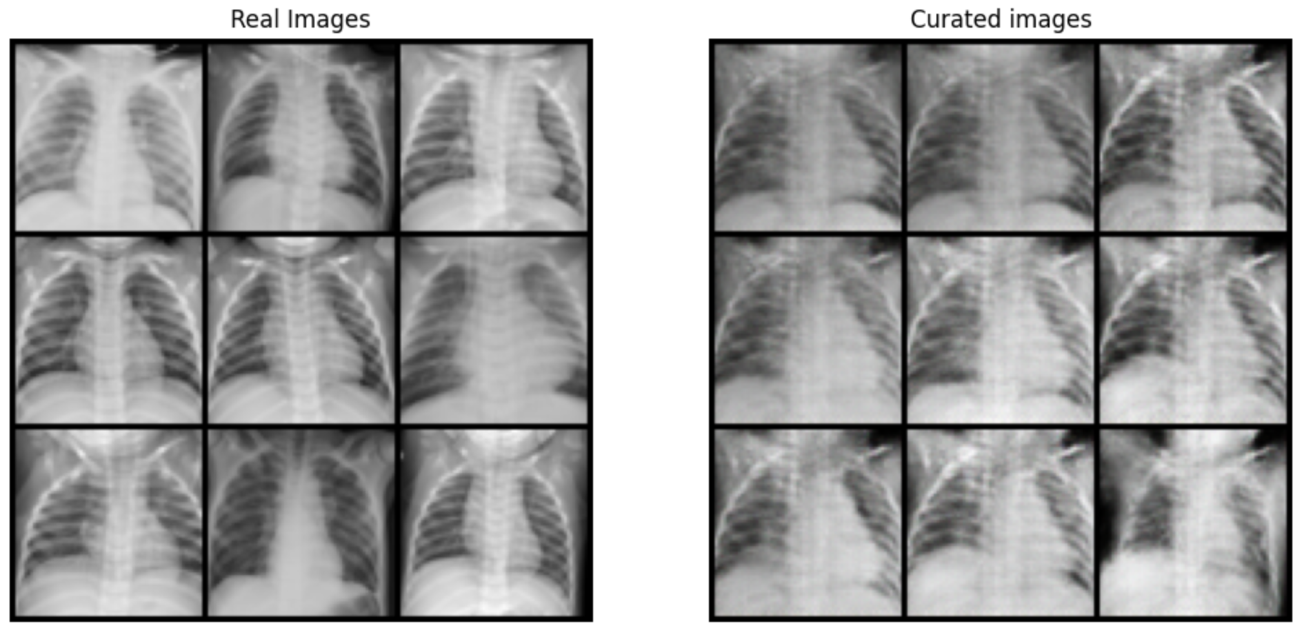 Understanding Image Generation A Beginners Guide To Generative Adversarial Networks Ovhcloud